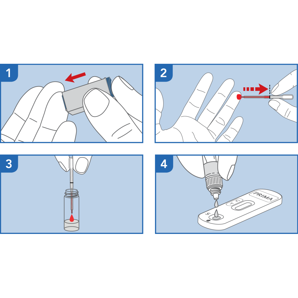 Prima Home Test Celiac Test | Birkenhead HealthPlus