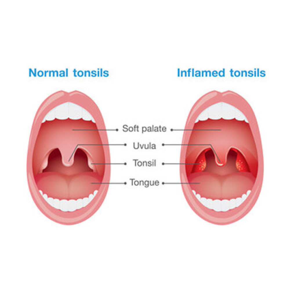 Sanderson Throat FX Gummy Lozenges 60s - Birkenhead Health ...