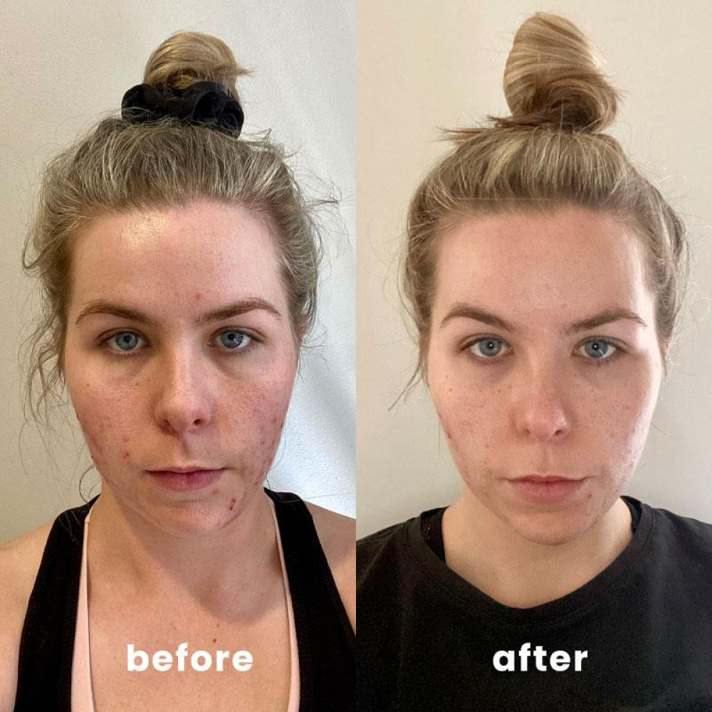 Vida Glow Radiance Advance Repair | Birkenhead HealthPlus